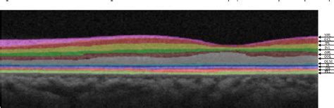 Figure 1 From Deepretina Layer Segmentation Of Retina In Oct Images Using Deep Learning