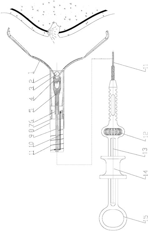 Improved Hemostasis Clamp For Being Used Under Endoscope And Clamp Part