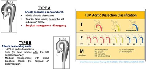 Thoracic Aortic Aneurysm Classification