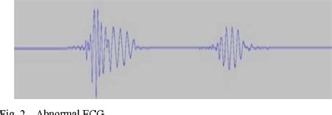 Figure 2 From Ecg Signals Classification Using Mfcc Coefficients And