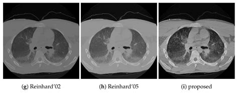 Algorithms Free Full Text A Weighted Histogram Based Tone Mapping
