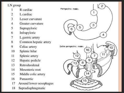 Hilar Cholangiocarcinoma In My Point Of View Ppt