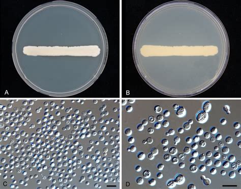 Cryptococcus Neoformans Cbs 8710 800px Atlas Of Clinical Fungi