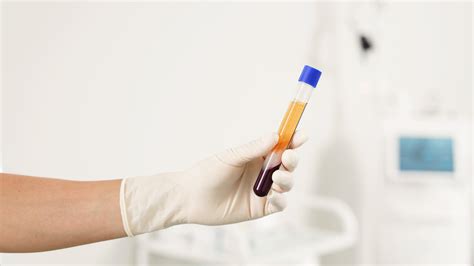 What To Know About Prp Injection Therapy Sdomg