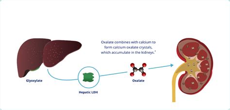 About Primary Hyperoxaluria Ph Uncovering Ph