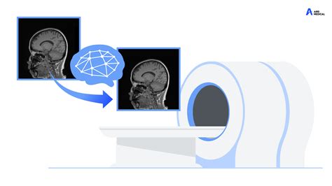 Mri Through The Eyes Of Artificial Intelligence Principles Of High Quality Image Reconstruction