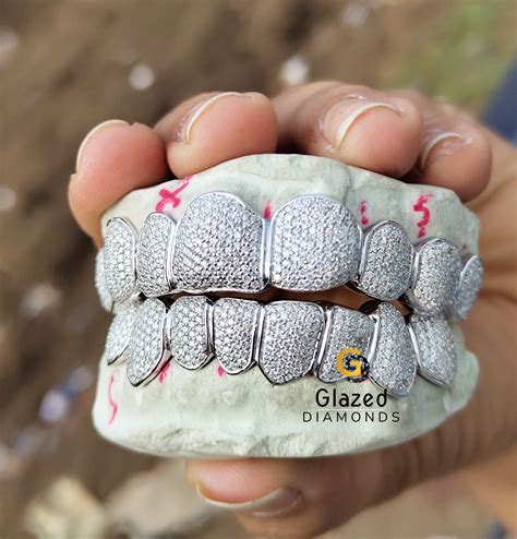 Moissanite Grillz Custom Fully Iced Out Moissanite Diamond Grillz