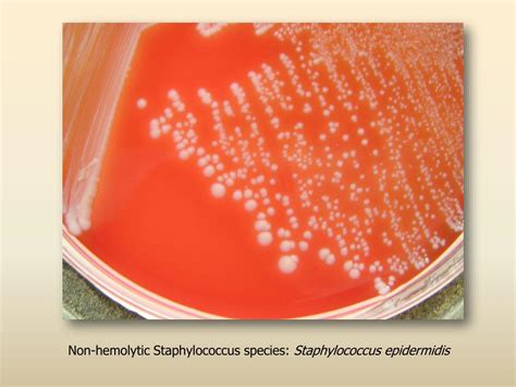 Ppt Isolation And Identification Of Staphylococci Powerpoint Presentation Id 6207093