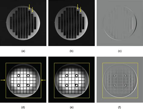 Nonlinear Gradient Field Mapping Using A Spherical Grid Phantom For 3 And 7 Tesla Mr Imaging