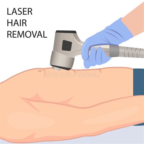 A Bare Chested Man Undergoes A Laser Hair Removal Procedure For A Beautiful Stock Vector