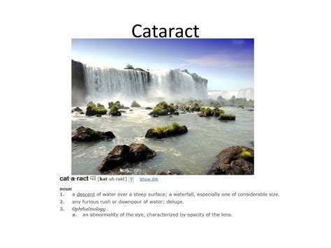PPT Cataract And Cataract Surgery PowerPoint Presentation Free Download ID