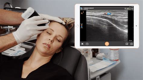 Vascular Mapping For Temporal Injection Clarius