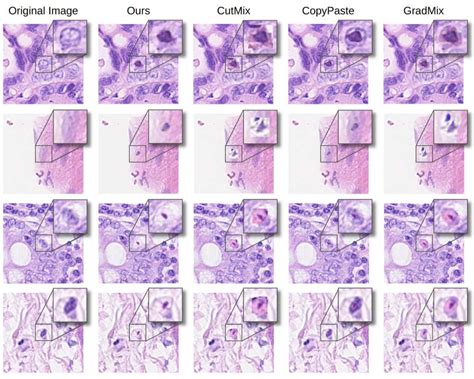 [논문 리뷰] Nucleimix Realistic Data Augmentation For Nuclei Instance Segmentation