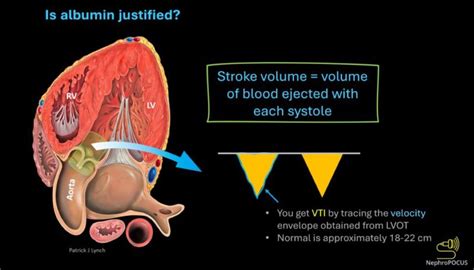 Pocus Cirrhosis Aki Nephrology Ultrasound Nephrology Medicine