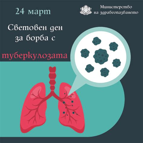 В ход са безплатните консултации за туберкулоза в страната • МЗ