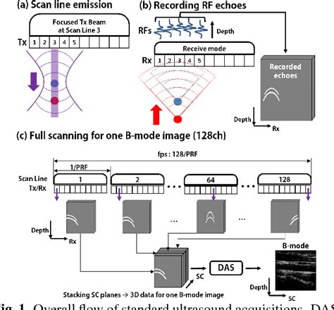 Figure 1 From Compressive Dynamic Aperture B Mode Ultrasound Imaging Using Annihilating Filter