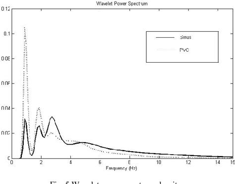 Figure 1 From Wavelet Power Spectrum Analysis For Pvc Discrimination Semantic Scholar