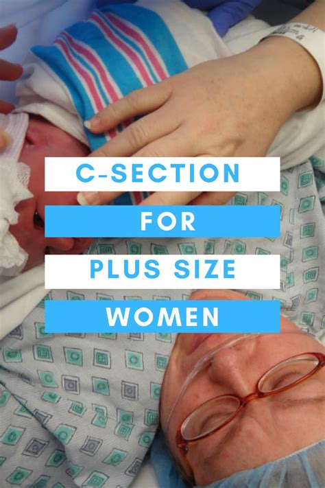 C Section For Plus Size Women Everything You Need To Know Plus Size Women Plus Size C Section