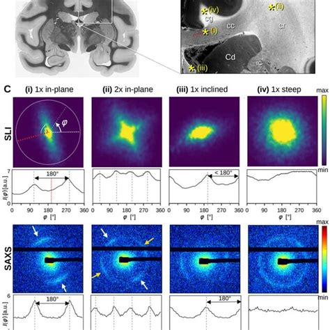 Diffusion MRI measurement of a x x cm³ human brain specimen μm Download Scientific