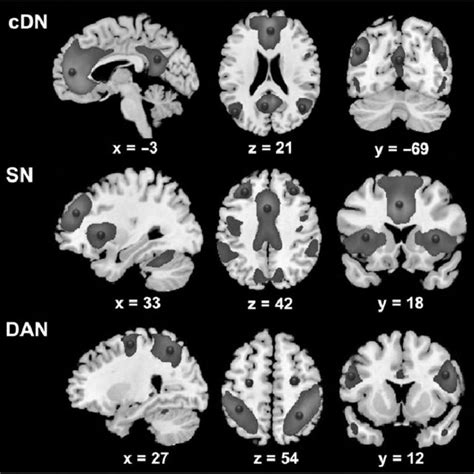 Vois Identified Using Spatial Independent Component Analysis Ica The