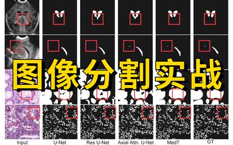 研究生必看！图像分割经典项目实战之u Net医学细胞分割实战学不会up主下跪！ 人工智能深度学习图像分割图像处理