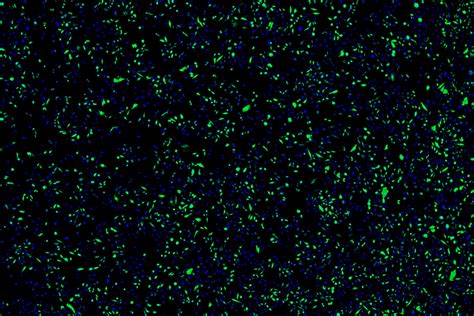 Plate Reader With Live Cell Imaging And Real Time Cytometry