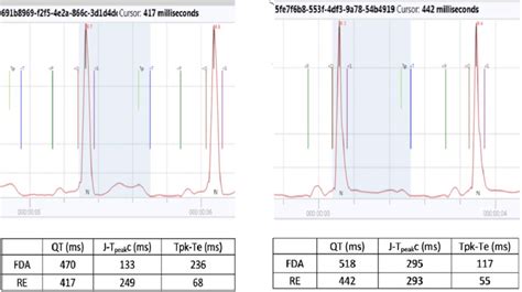 Examples Of Differences Between The Fda And Rhythm Express Measurements