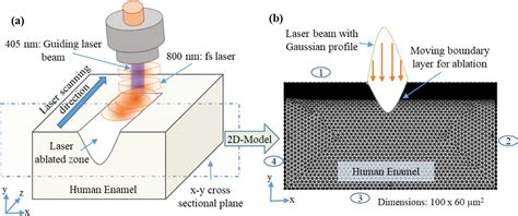 Ultrashort Pulsed Laser‐assisted Direct Restoration Of Human Enamel Using 3d Printable