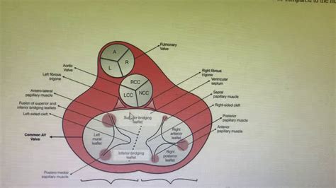 Details Of Avcd 1 Youtube
