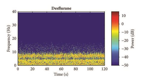 Temporal And Spectral Dynamics Between Propofol And Desflurane Group