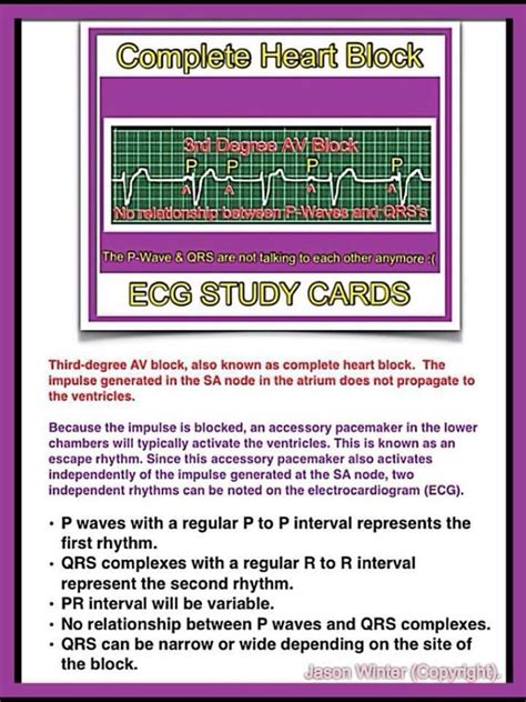 How To Read An Ecg Interpretation Components Artofit