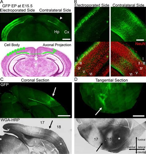 Tangential And Laminar Distribution Of Interhemispheric Axon