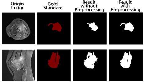 Comparison Of Segmentation Results Of The Model With And Without Data