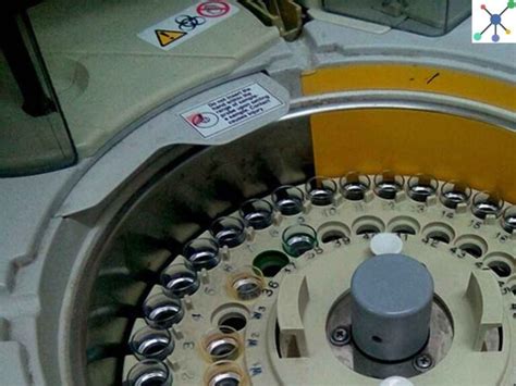 Biochemistry Analyzer Uses And Principle A Comprehensive Guide