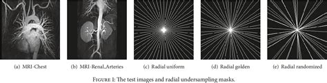 Figure 1 From Compressed Sensing Mri Reconstruction With Multiple