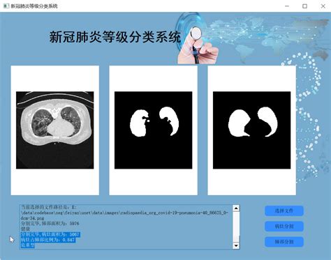python基于改进unet的新冠肺炎等级分割系统（源码＆教程） unet python源码 csdn博客