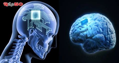 మర వయకత మదడల ఎలకటరనక చప ఇద ఎల పనచసతదట