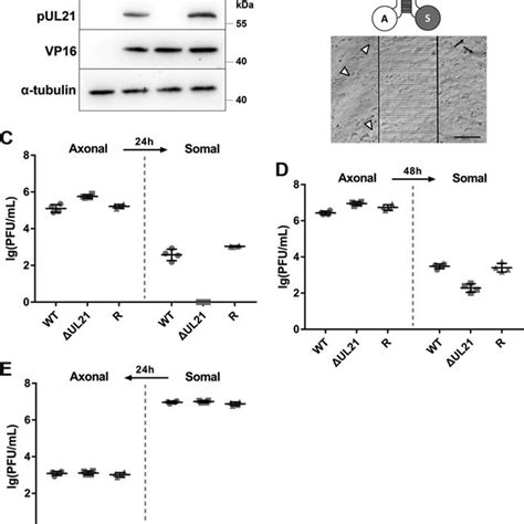 The Efficiency Of Retrograde And Anterograde Axonal Transport Of Prv