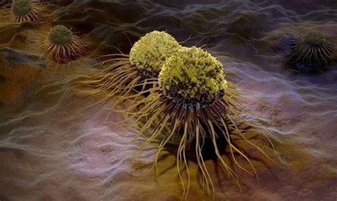 Krebs Sprechstunde Doktor Stutz