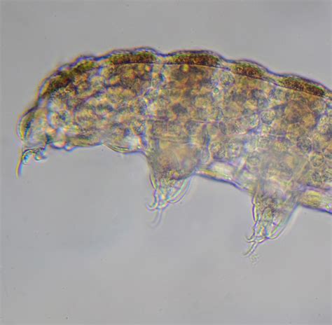 Wastewater Microbes Huma