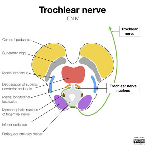 Radiopaedia Drawing Midbrain At Level Of Trochlear Nerve English Labels Anatomytool