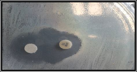 Phenotypic Identification Of Metallo Beta Lactamase Producing Download Scientific Diagram