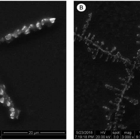 Scanning Electron Microscopic Results Of Genomic DNA Acted By HJH 3 Download Scientific