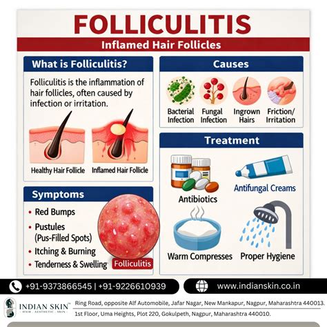Indian Skin 🔴 Folliculitis Inflamed Hair Follicles Facebook