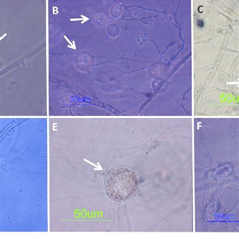 Interaction Zone Between Endophytic Trichoderma Virens Isolate Tv And