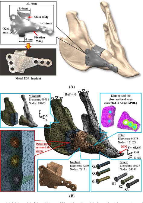 Figure 1 From Integrating Finite Element Death Technique And Bone Remodeling Theory To Predict