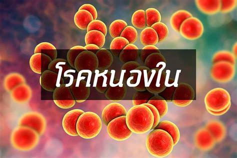 👉 โรคหนองในคืออะไร โรคหนองใน เป็นโรคติดต่อทางเพศสัมพันธ์ชนิดหนึ่งที่พบมากที่สุด ของโรคติดต่อ