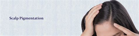 Scalp Pigmentation Scalp Pigmentation