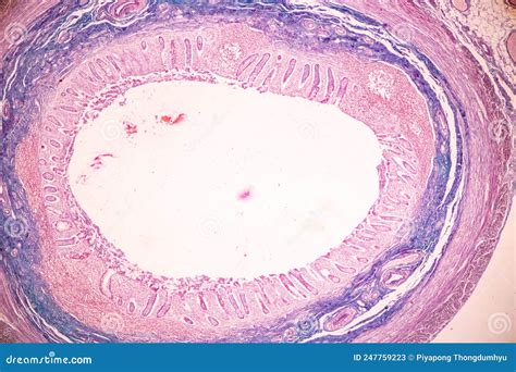 Small Intestine Duodenum And Vermiform Appendix Human Under The Microscope Stock Image Image