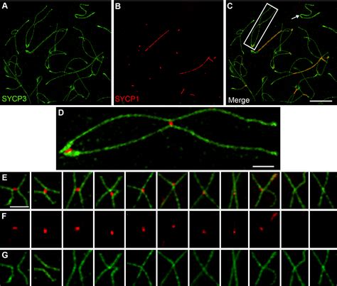 Figure 4 From Interplay Between Synaptonemal Complex Homologous Recombination And Centromeres